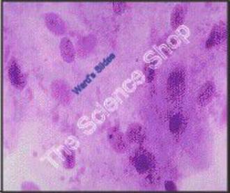 Barr Bodies (sm) CV Cheek cells of normal human female Many nuclei show ...